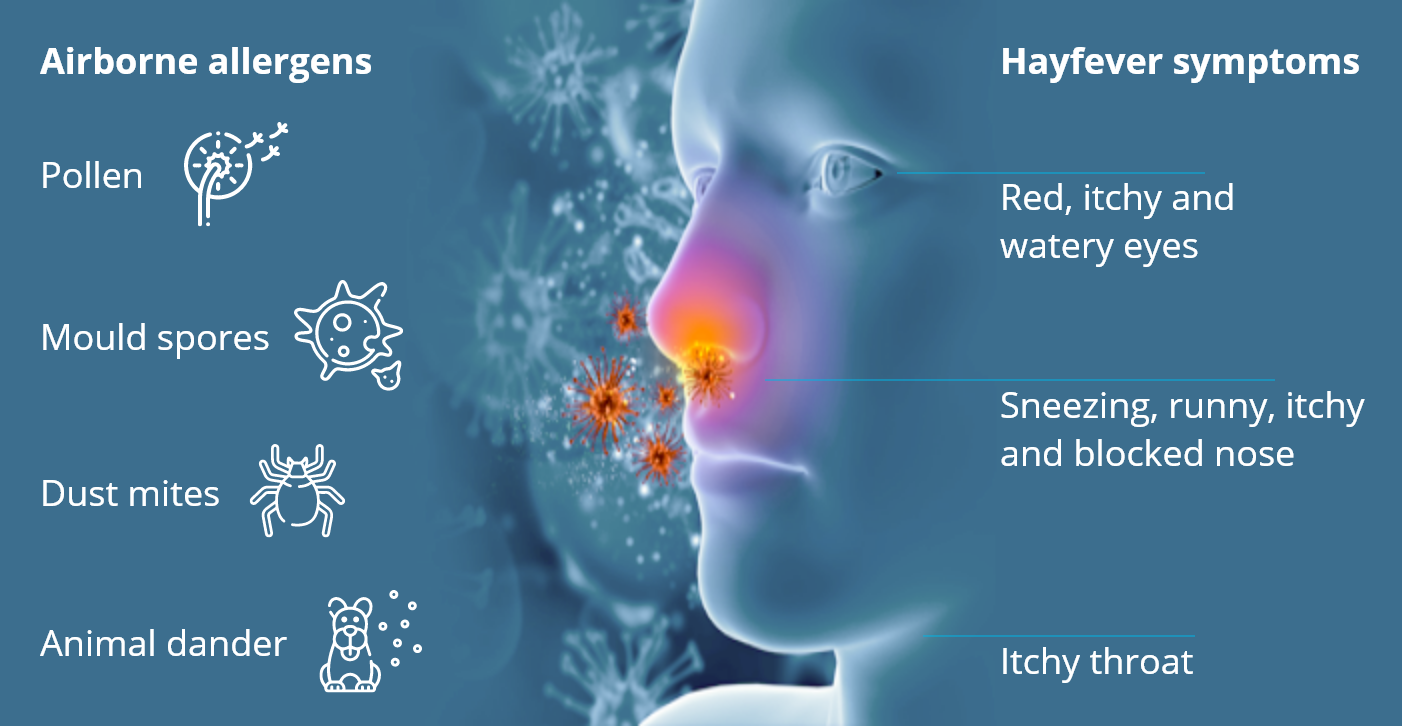 What is hay fever? Causes of hay fever in NZ | Dymista®